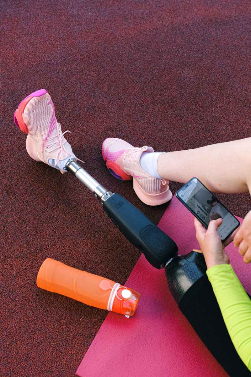 Prosthetic Possibilities: Transforming Lives with Innovation – The ...