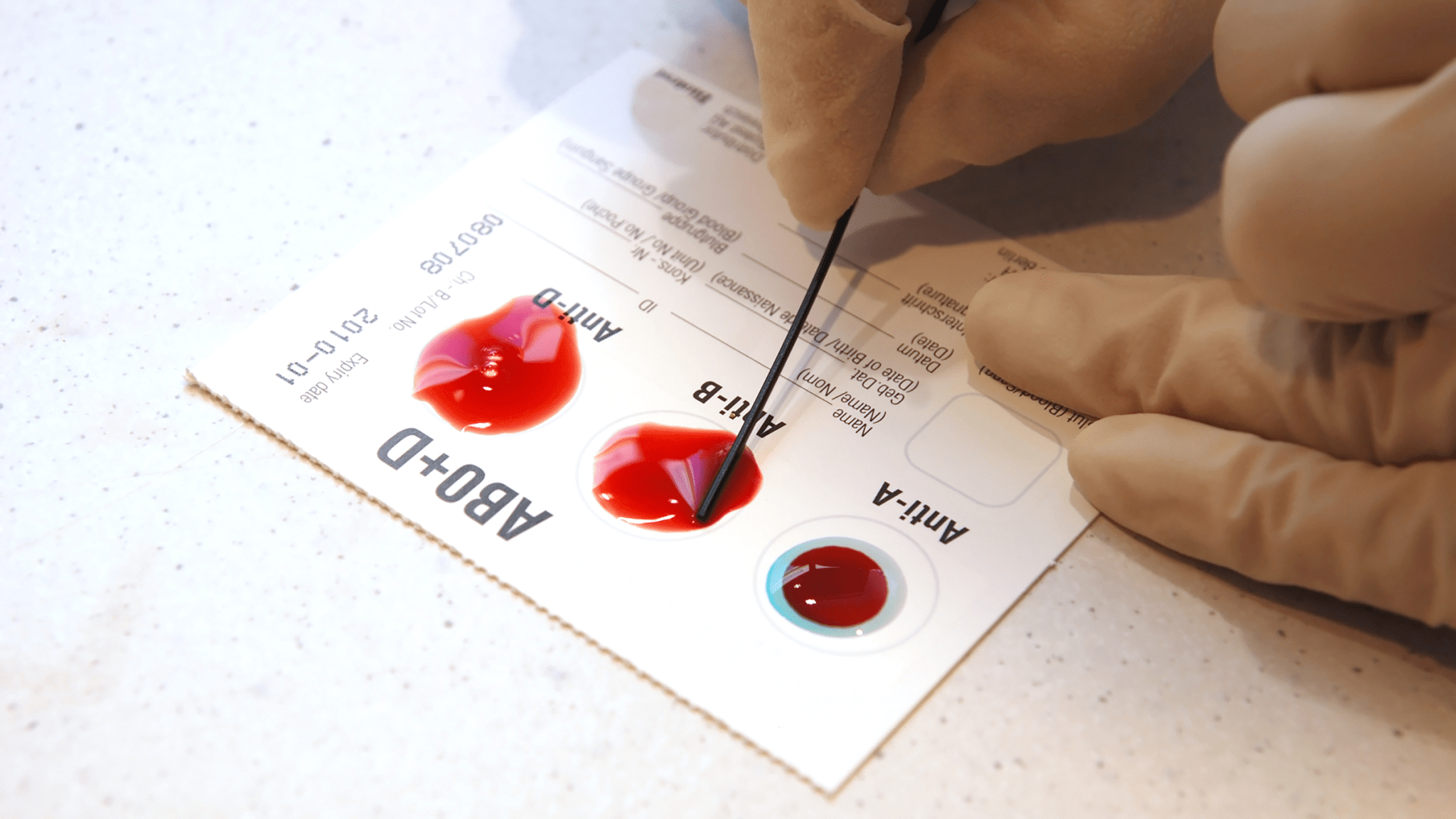 Blood Typing – The Golden Thread